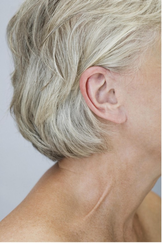 Exploring Medical Treatments for Wrinkly Neck: What Are Your Options ...